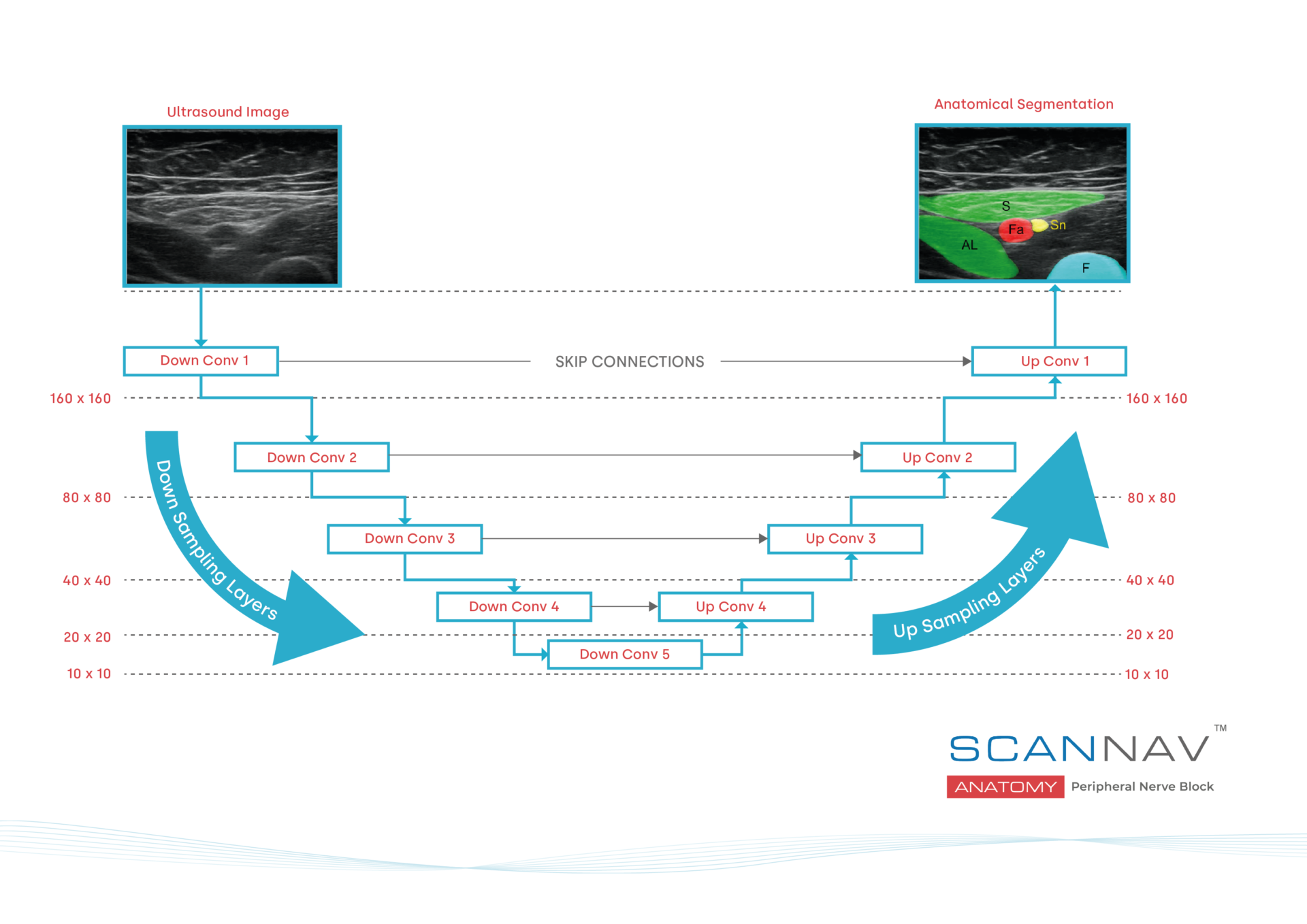 Artificial Intelligence for Ultrasound Scanning in Regional Anaesthesia ...