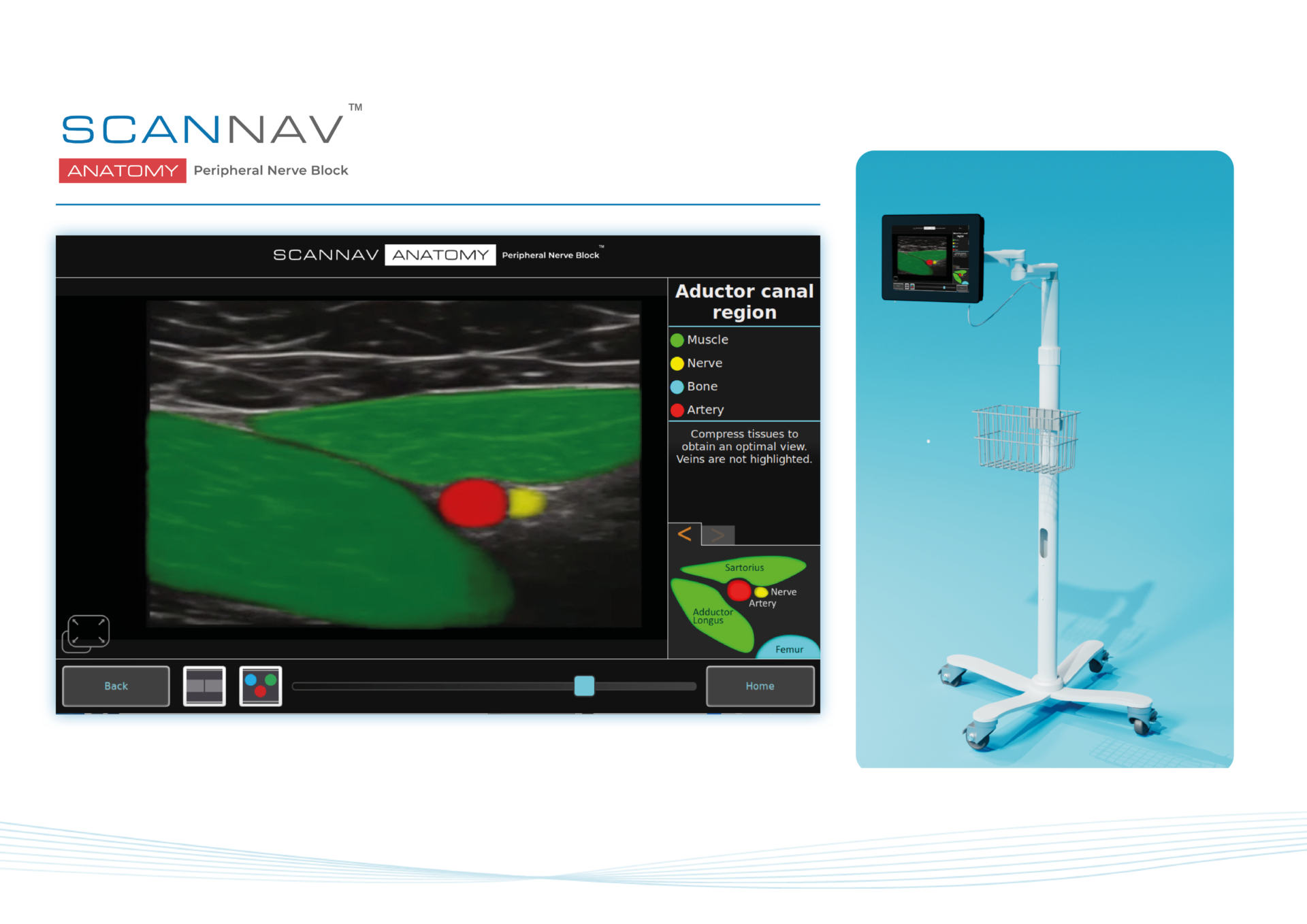 Artificial Intelligence for Ultrasound Scanning in Regional Anaesthesia ...