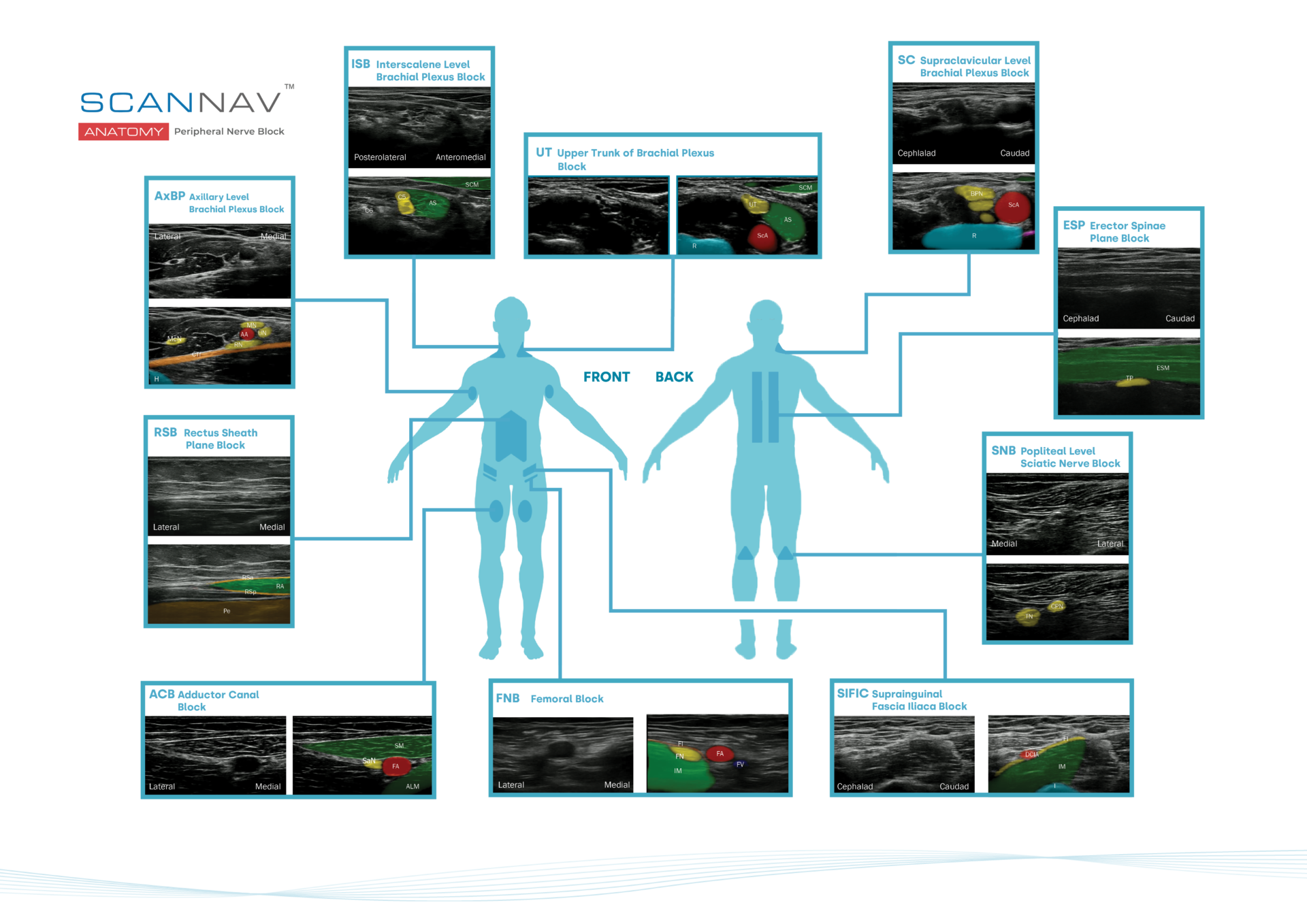 Artificial Intelligence for Ultrasound Scanning in Regional Anaesthesia ...